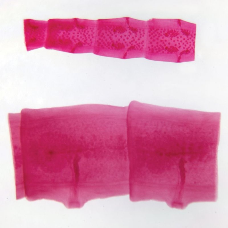 Carolina Tapeworm Proglottids Comparison Slide, Microscope Slide with ...